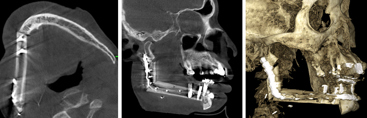News - CT scan vs. Cone Beam CT: an overview - News - CT scan vs. Cone ...