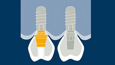 Design Principles for FDPs - Learning Modules - Academy - ITI