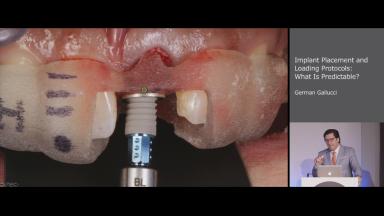 Implant Placement and Loading Protocols: What Is Predictable ...