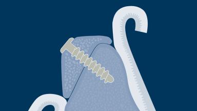 Principles of Staged Bone Augmentation - Learning Modules - Home - ITI