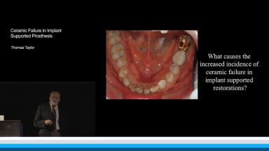Ceramic Failure in Implant-Supported Prostheses - Congress Lectures ...