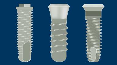 Selecting an Implant System - Assessments - Home - ITI