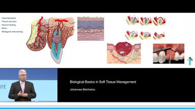 Biological Basics in Soft Tissue Management - Congress Lectures - ITI