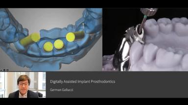 Digitally Assisted Implant Prosthodontics - Congress Lectures - Home - ITI