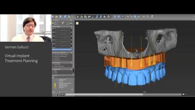 Virtual Implant Treatment Planning - Congress Lectures - Home - ITI