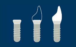 Healing of the Extraction Socket - Learning Modules - Home - ITI