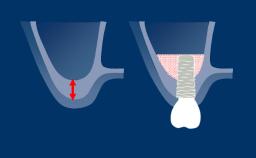 The SAC Classification - Assessments - Home - ITI