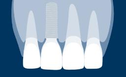 The SAC Classification 1st Edition - Learning Modules - Home - ITI