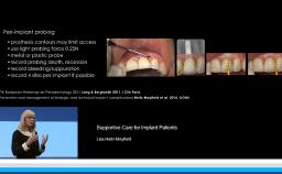 My ITI - Lisa J A Heitz-Mayfield - ITI