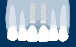 The SAC Classification - Assessments - Home - ITI